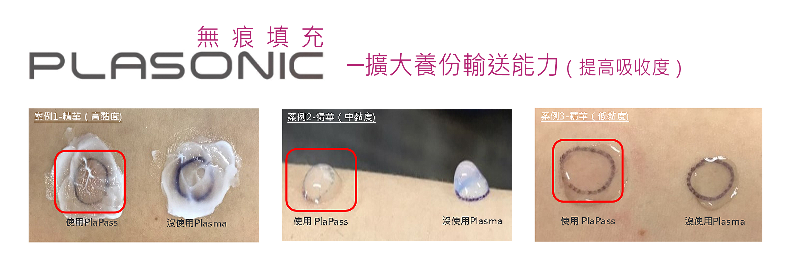 韓國「plasonic 等離子細胞再生療程」